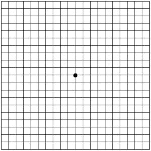 Age-Related Macular Degeneration (ARMD) | Cape Fear Retina