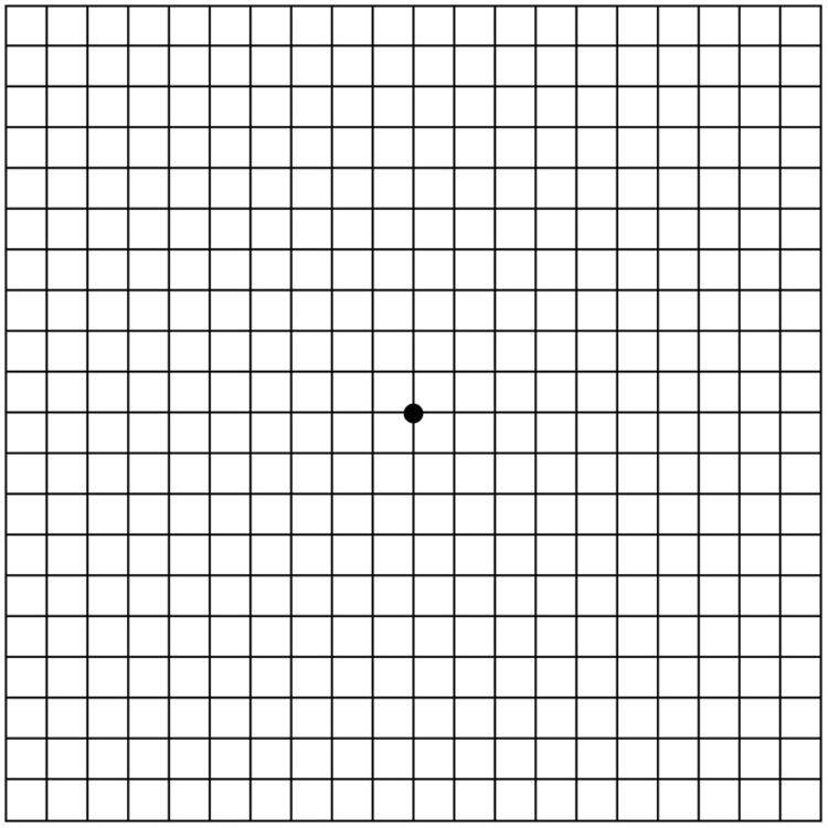 Age-Related Macular Degeneration (ARMD) | Cape Fear Retina